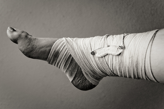 Common Dance Injuries and Treatments | ATOMIC Ballroom | Irvine, CA in ...